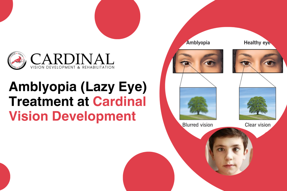 Eye Exercises for Strabismus | Improve Eye Alignment Naturally
